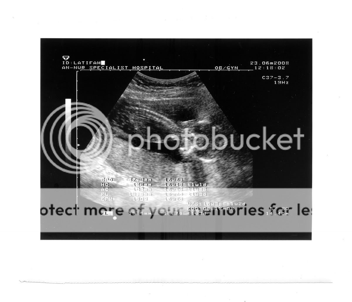 A New Life 16w3d | Gurindam Jiwa